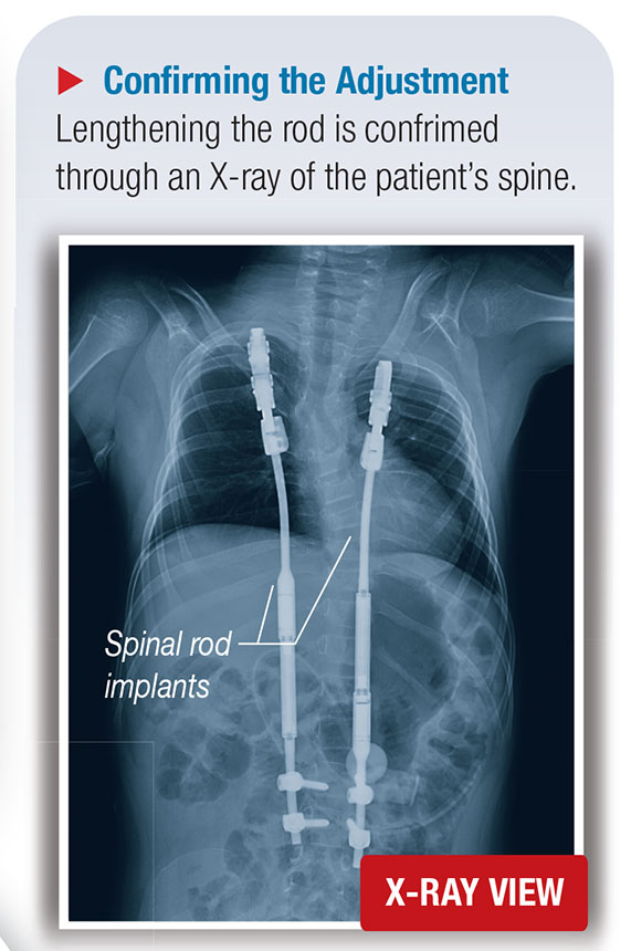 Remote Control Treatment – Pediatrics Nationwide
