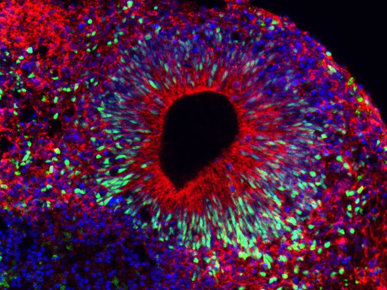 Brain Organoids Provide Novel Mechanistic Insight into Microcephaly ...