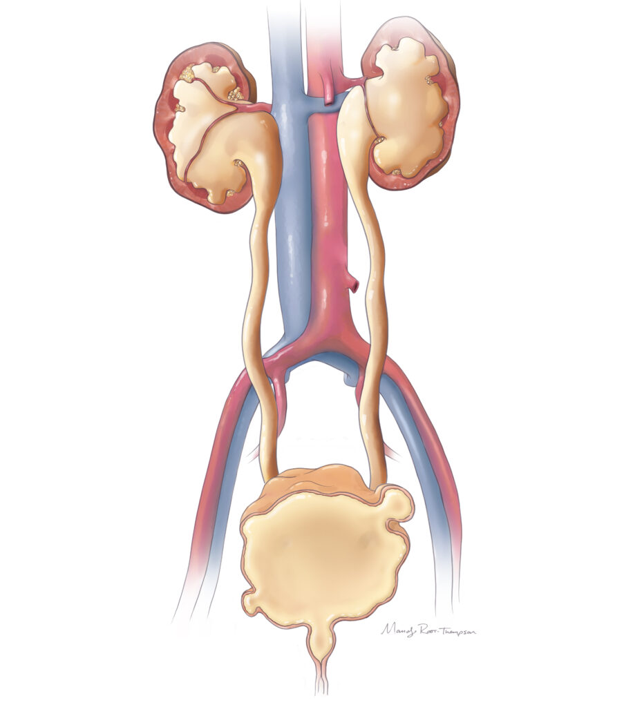 Innovations in Pediatric Nephrology and Urology: Spotlight on ...